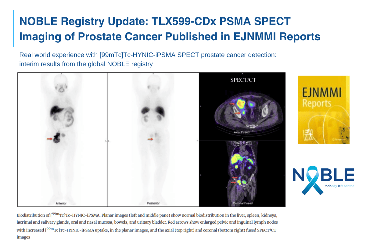 NOBLE Registry Update Published in EJNMMI Reports